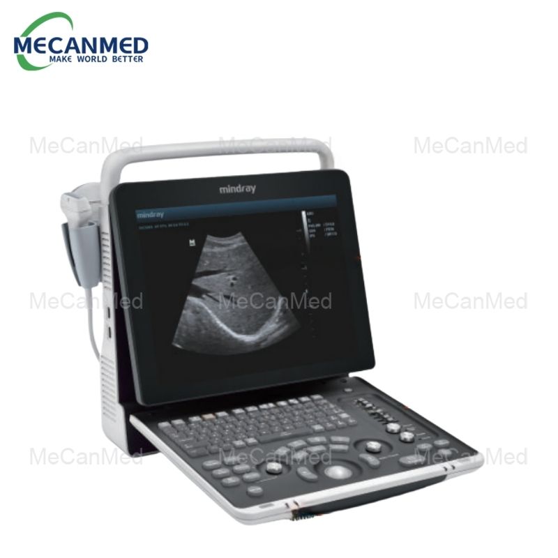 Mindray DP-50 Ultraschalldiagnosesystem